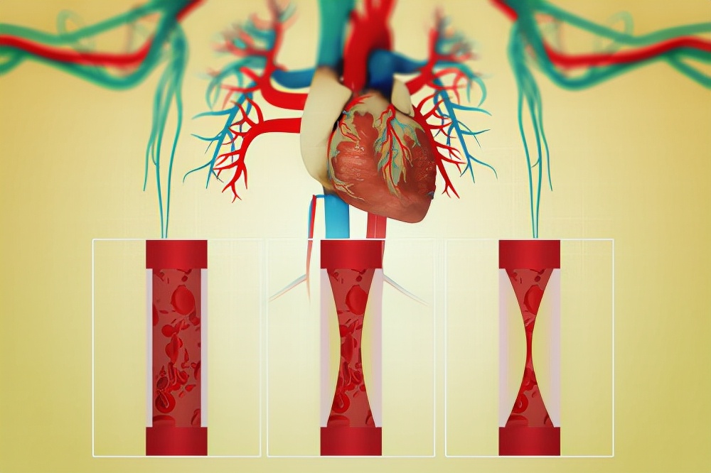 The "ABCDE Plan" that patients with coronary heart disease must know ...
