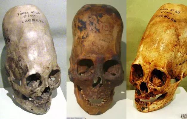 The discovery of a strange skull that made scientists stunned - iNEWS