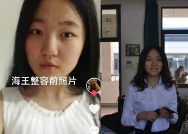 Xiang Sixing's plastic surgery was hammered, and the plastic surgeon ...