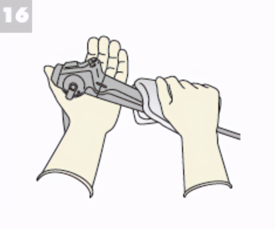 Bronchoscope cleaning guide (OLYMPUS) - iNEWS