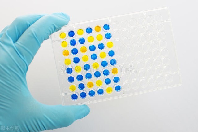 How much do you know about anti-Sm antibody and anti-U1RNP antibody ...