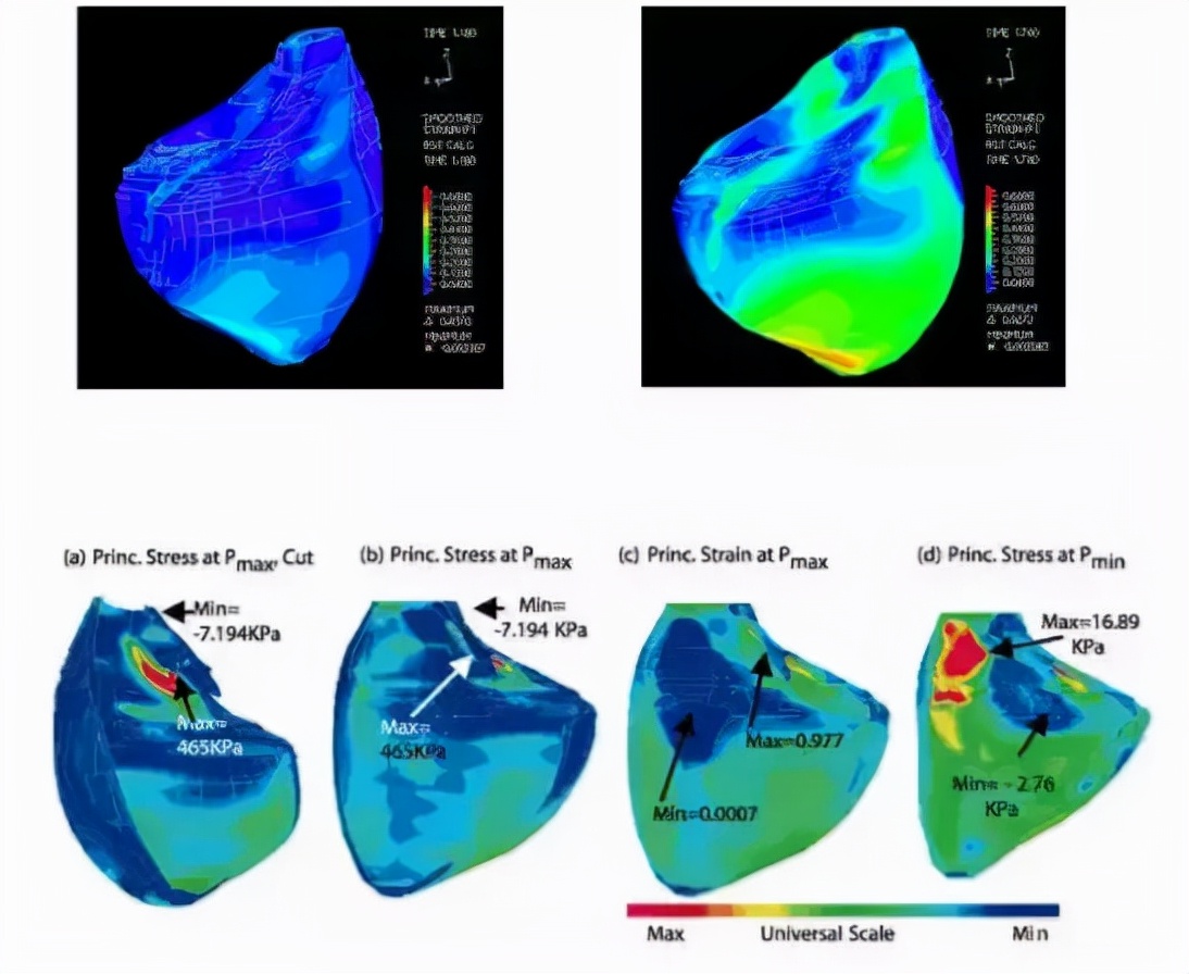 Three-dimensional modeling technology and finite element analysis of ...