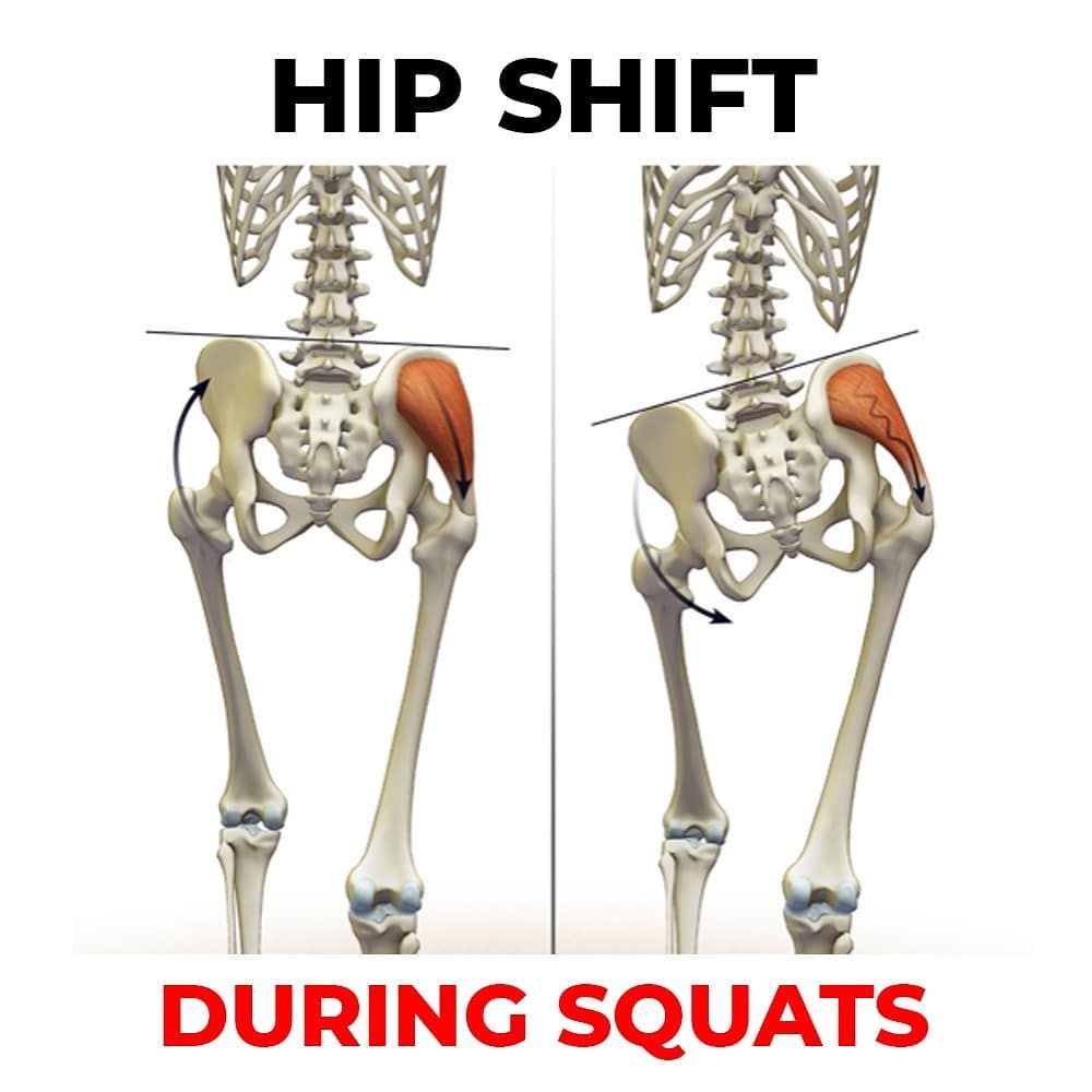 Why does the hip shift to one side when squatting? how to solve this ...