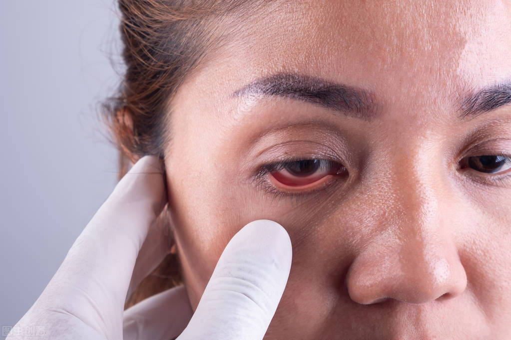 How to improve the tear ditch hidden in the face?The doctor shared 3 ...