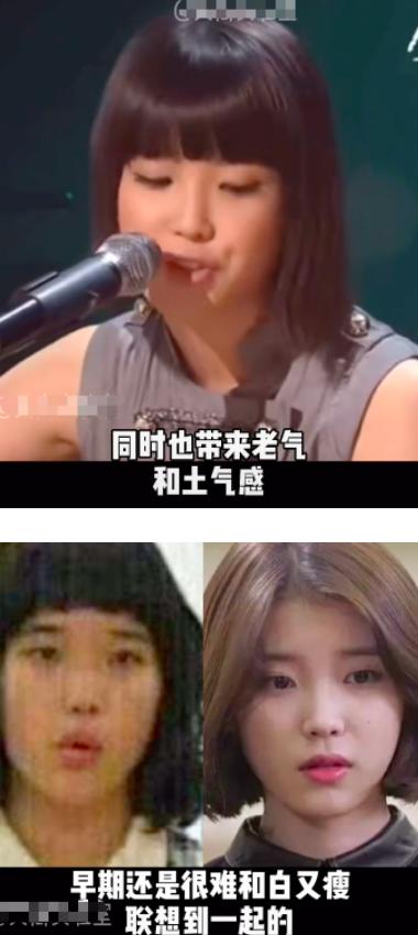 The photos of suspected IU before plastic surgery were exposed. After ...