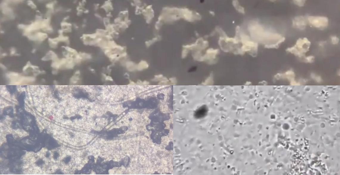 The belly button is connected to the intestine.1000 times magnification ...