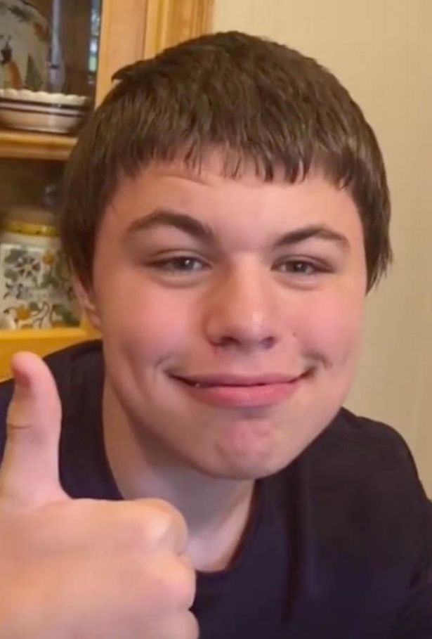 The record for the world's largest mouth was set. The teenager opened ...