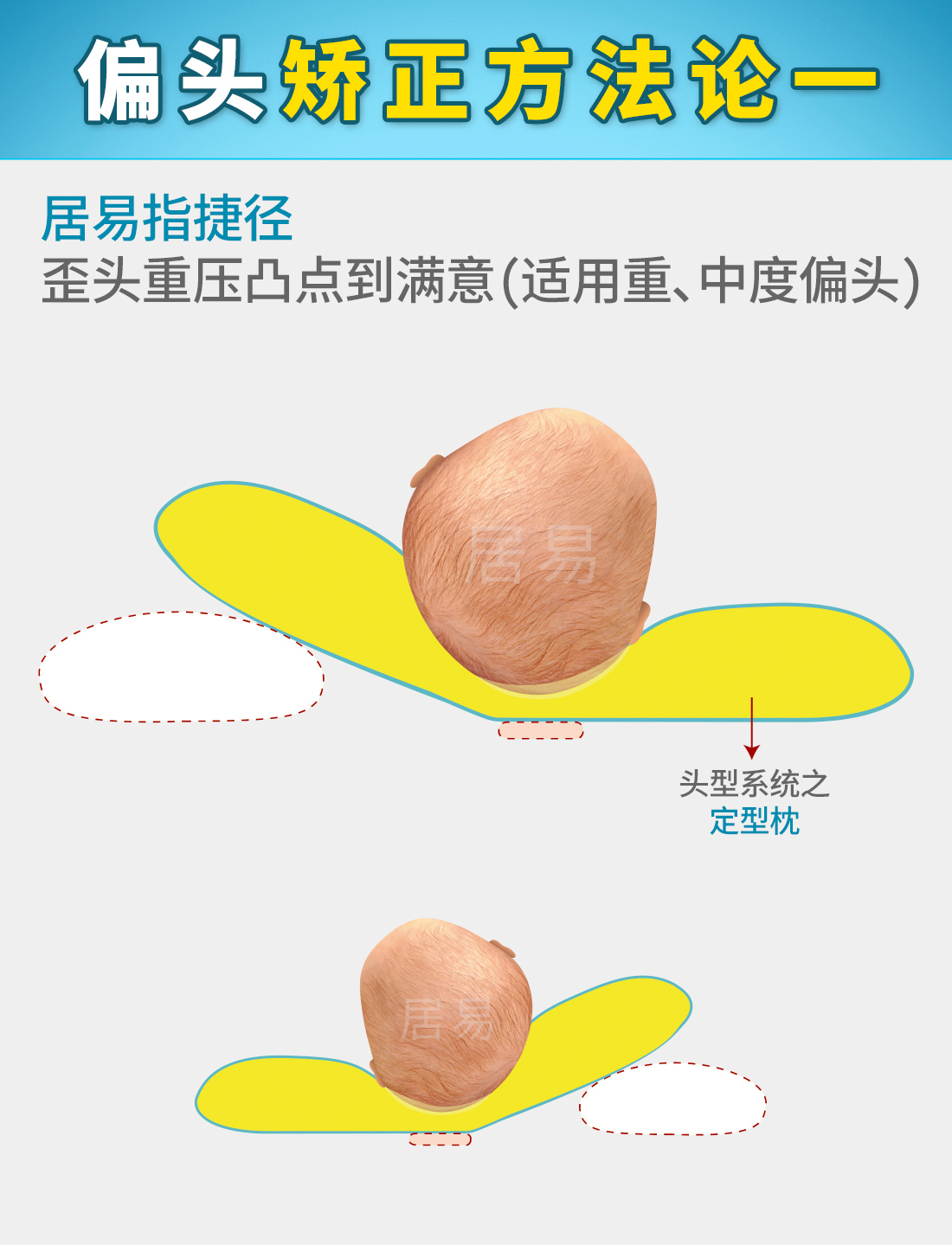 The secret of baby's head shape (8) Shortcut to correct head deviation ...