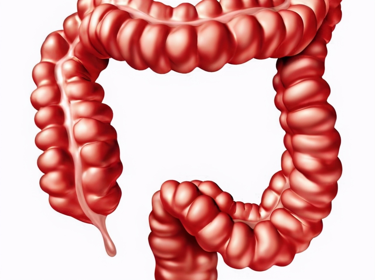 Nodules, polyps, cysts, hyperplasia, which is a precursor to cancer ...