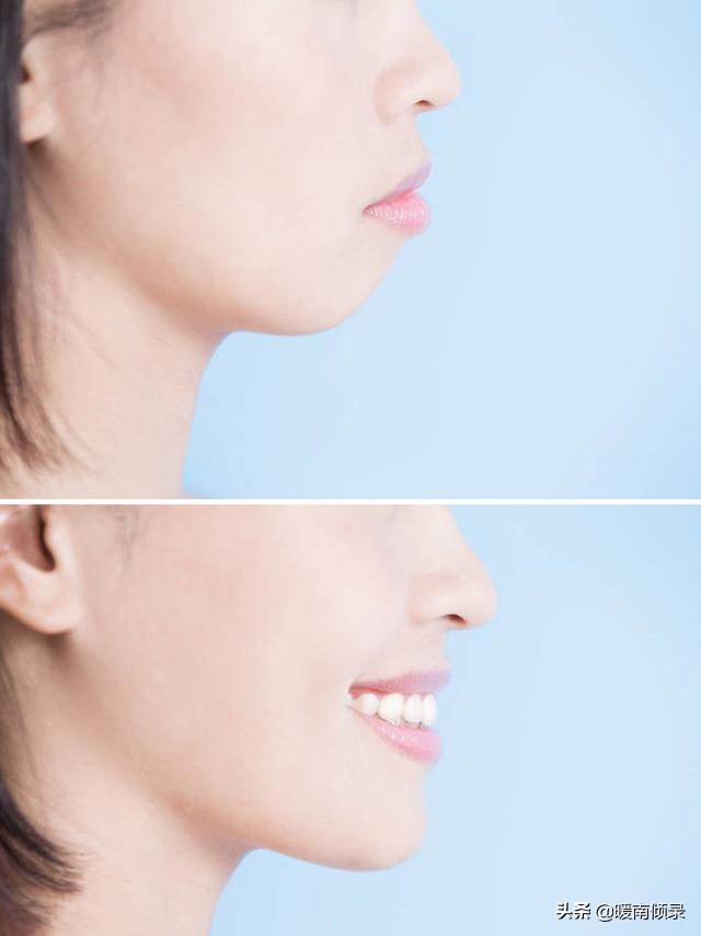 What does the saying "The chin is as sharp as a cone, and wealth turns ...