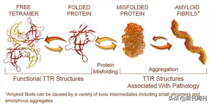 Heart failure?"Starch Man"?, Take you to know more about rare diseases ...