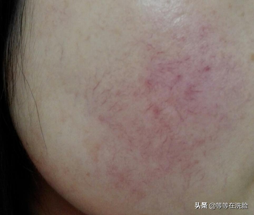 Sensitive muscle?It's time to change to a different way of skin care ...