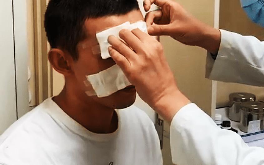 Wu Lei's face was wounded during the filming, and makeup was applied to ...
