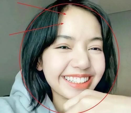 After Lisa's hairline crisis, Jennie also became "bald". The new ...