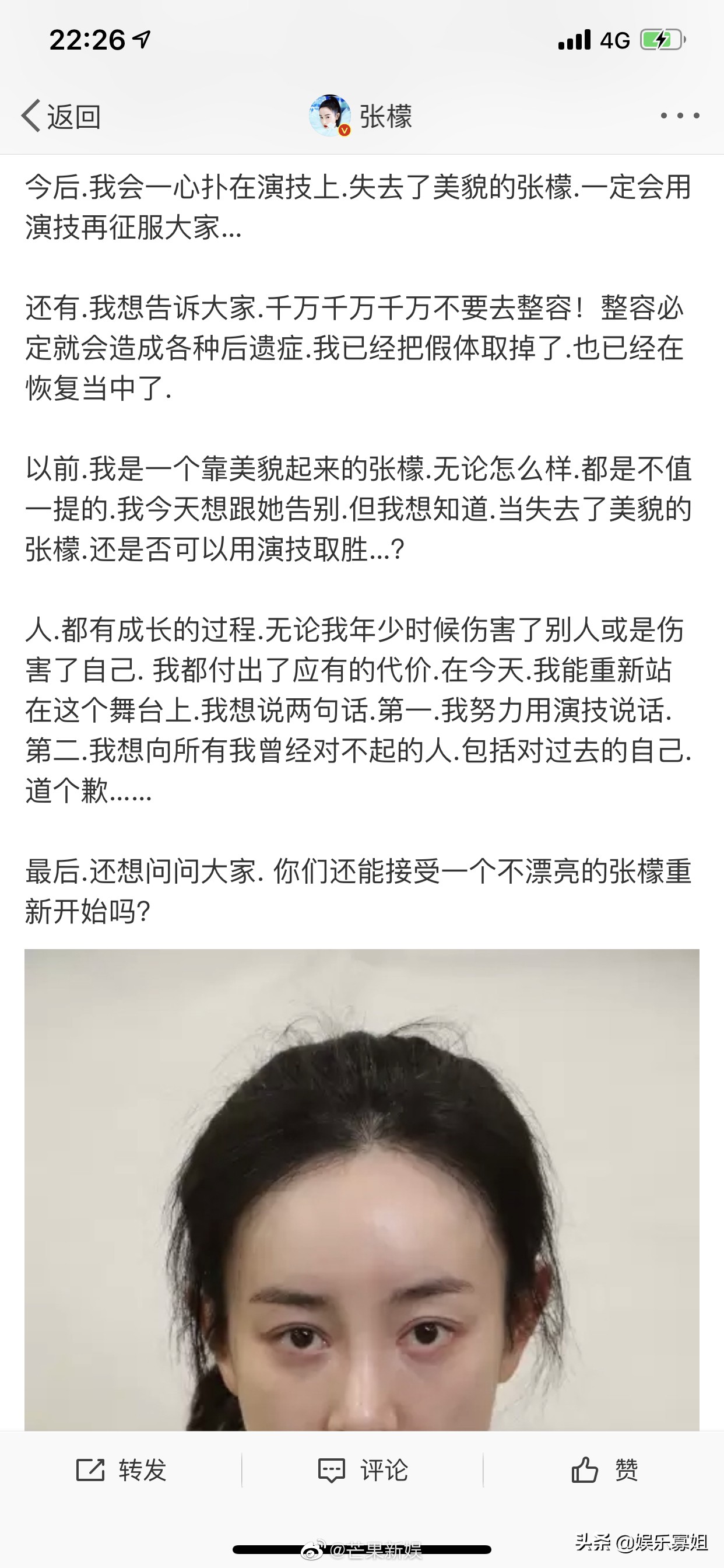 Zhang Meng sent a long post about plastic surgery and said he wanted to start from scratch ...