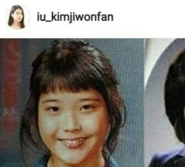 The photos of suspected IU before plastic surgery were exposed. After ...
