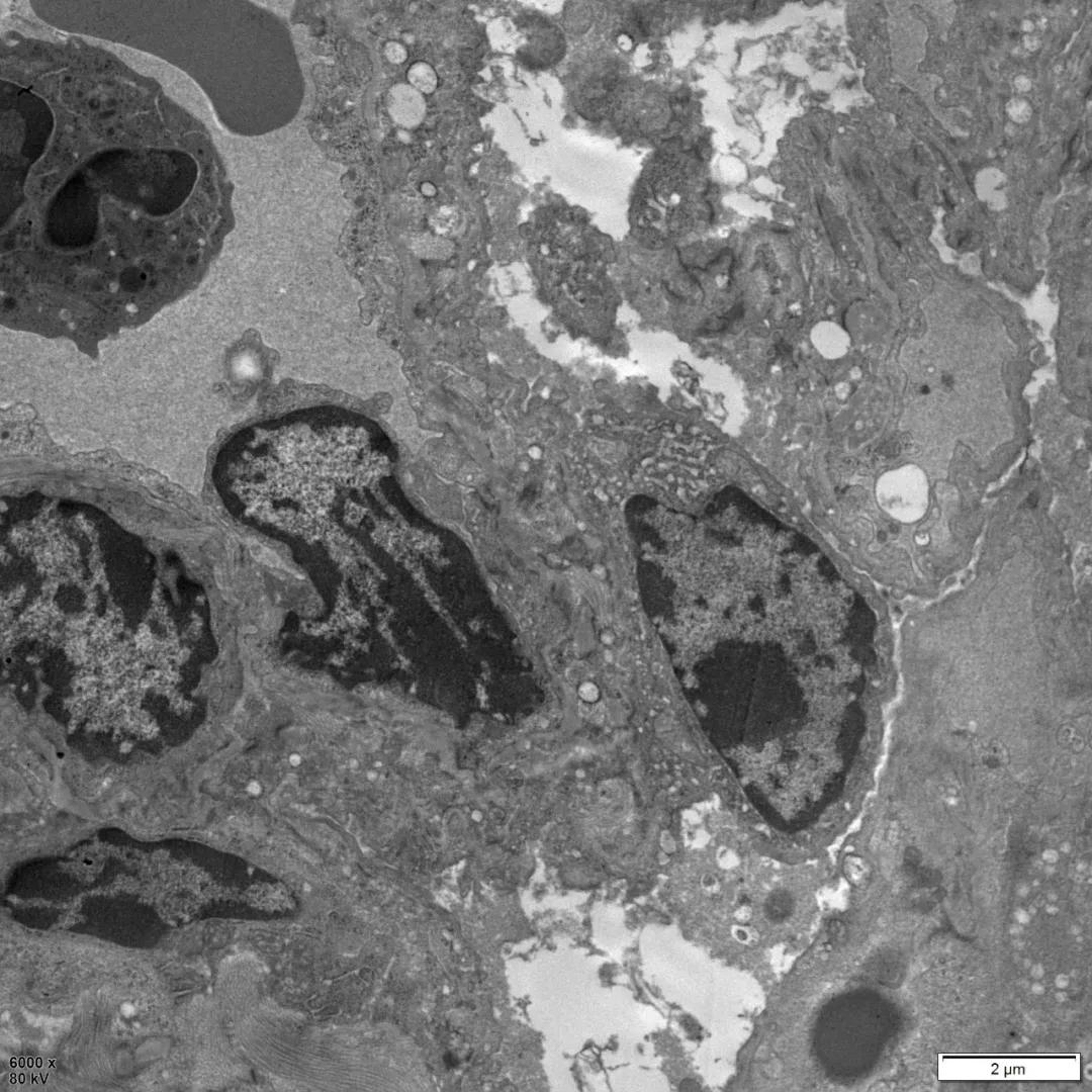 Smoking combined with lipopolysaccharide (LPS) to prepare rat chronic ...