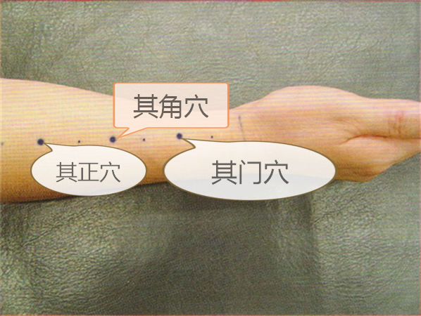 Qimen acupoints on human hand points for health and wellness in ...