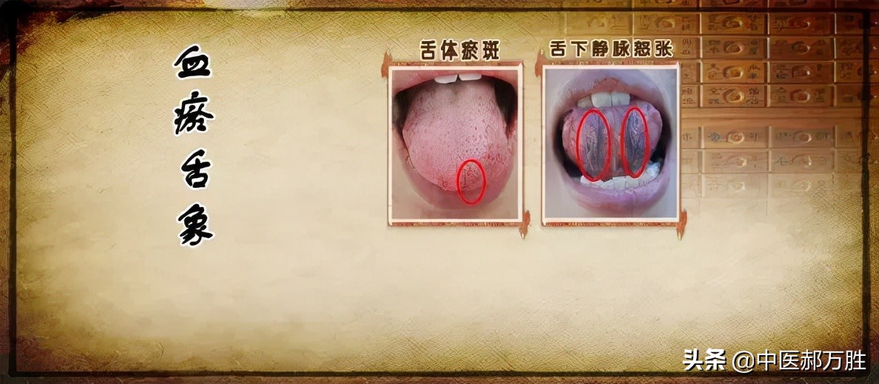 Doctor Hao talks with you about the understanding and treatment of ...