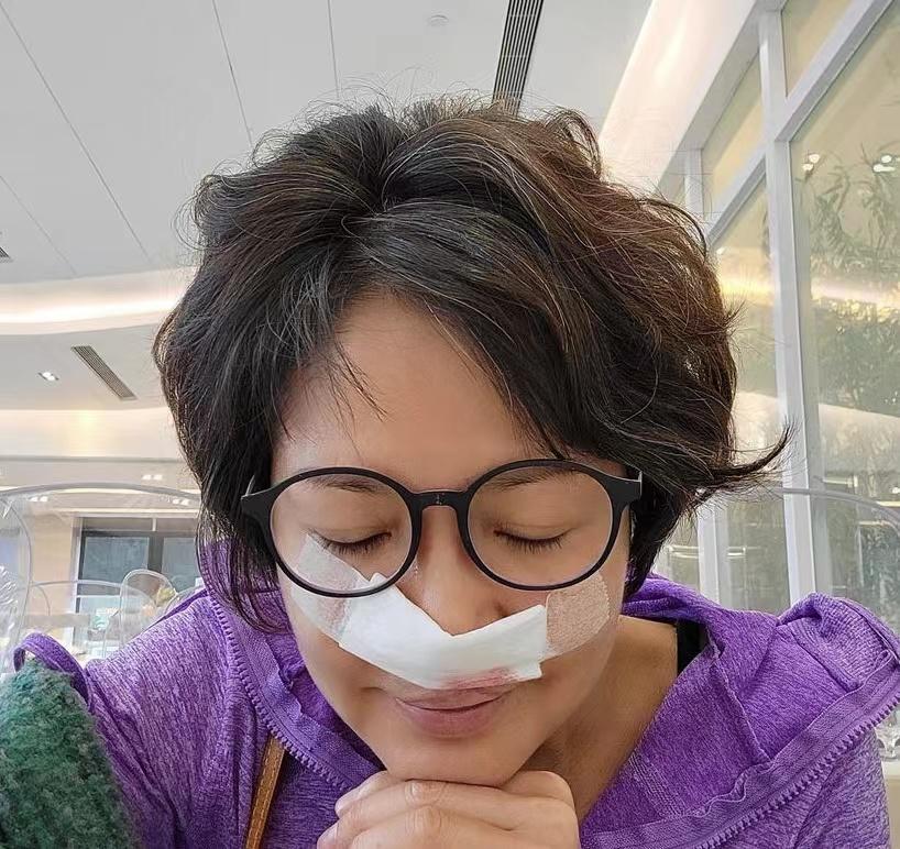 The famous TVB actress suddenly suffered from facial paralysis and ...