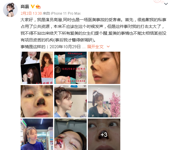 The post-95 actress Gao Liu failed to undergo plastic surgery and ...