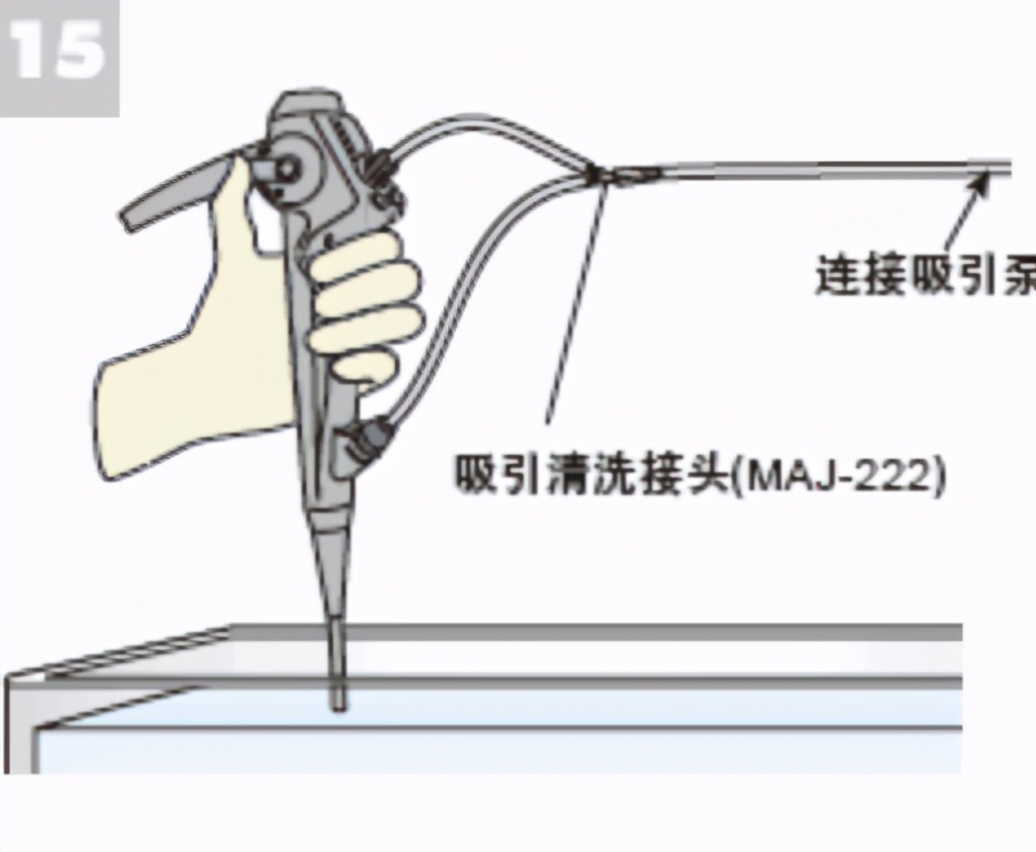 Bronchoscope cleaning guide (OLYMPUS) - iNEWS