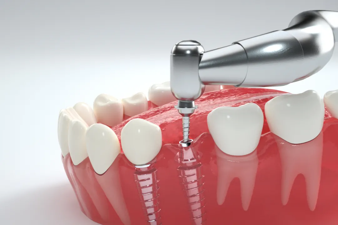 Old people often do this, and they can have good teeth at the age of 80 ...