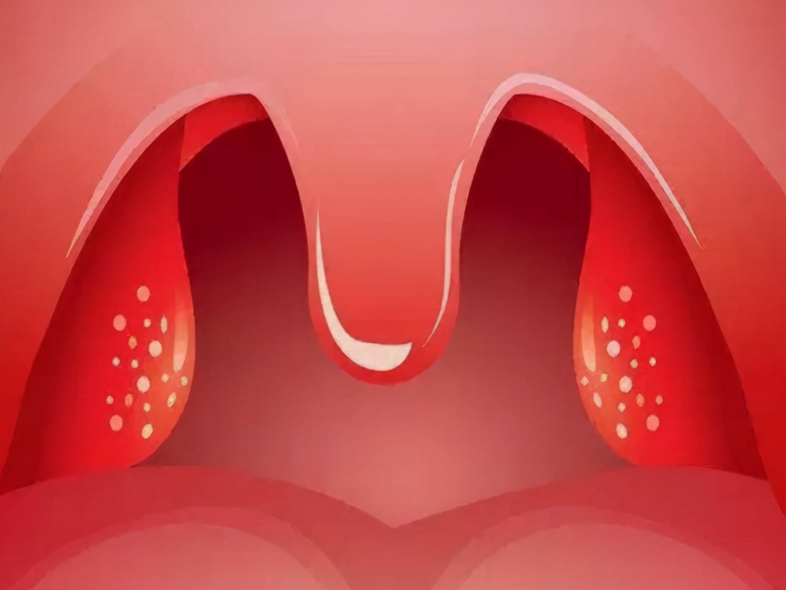 The female singer has an advanced stage of cancer. The tumor ...