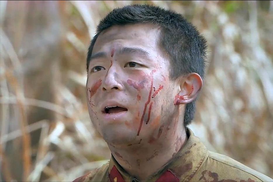 Why did Japan have so few severely wounded soldiers in World War II ...