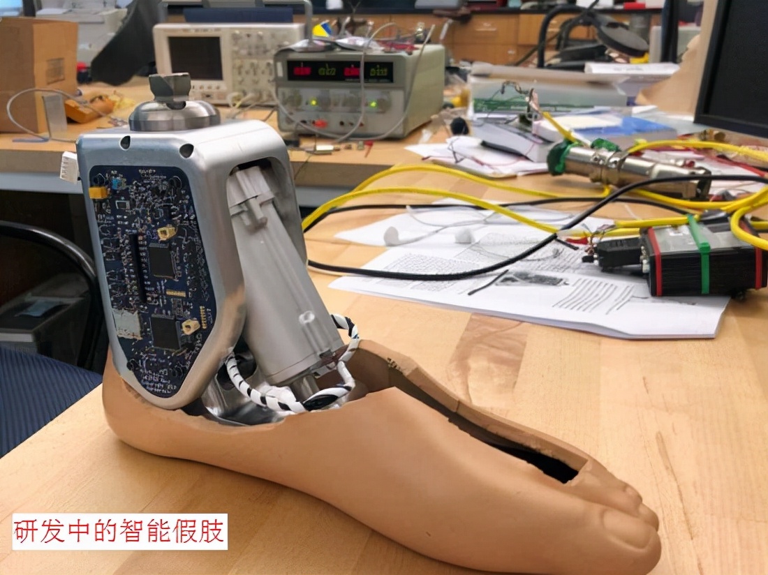 What is a smart prosthesis - iMedia