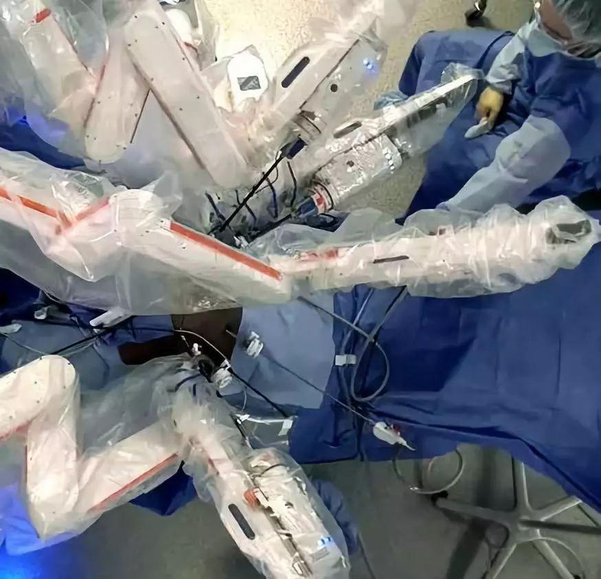 Challenge Da Vinci!Medtronic's Hugo robot is used in clinical practice ...