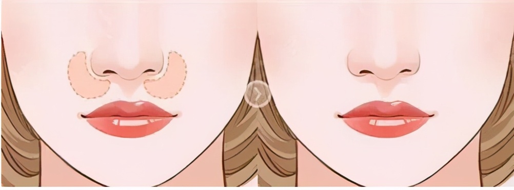 In her 30s, her face collapsed like a 50-year-old aunt. She ...