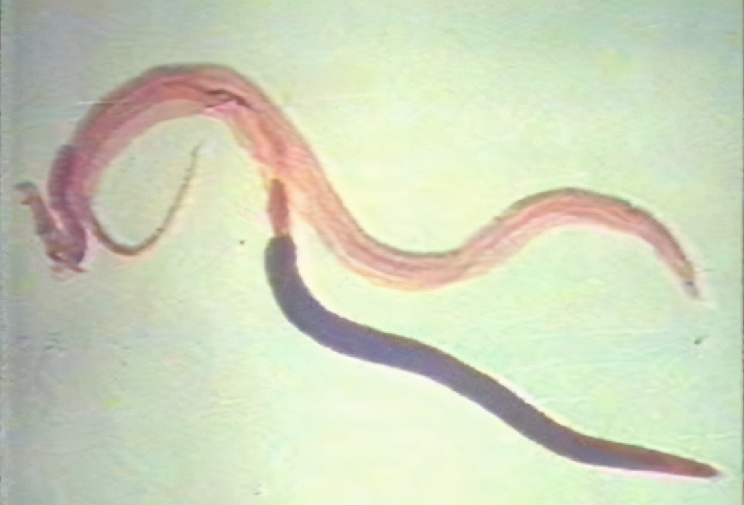 The monster that covets the human body-the blood sucking worm - iNEWS