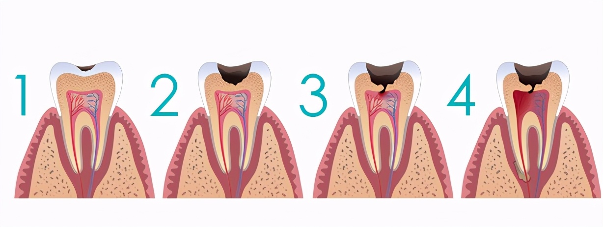 What are the "secrets" hidden behind the black lines appearing on the ...