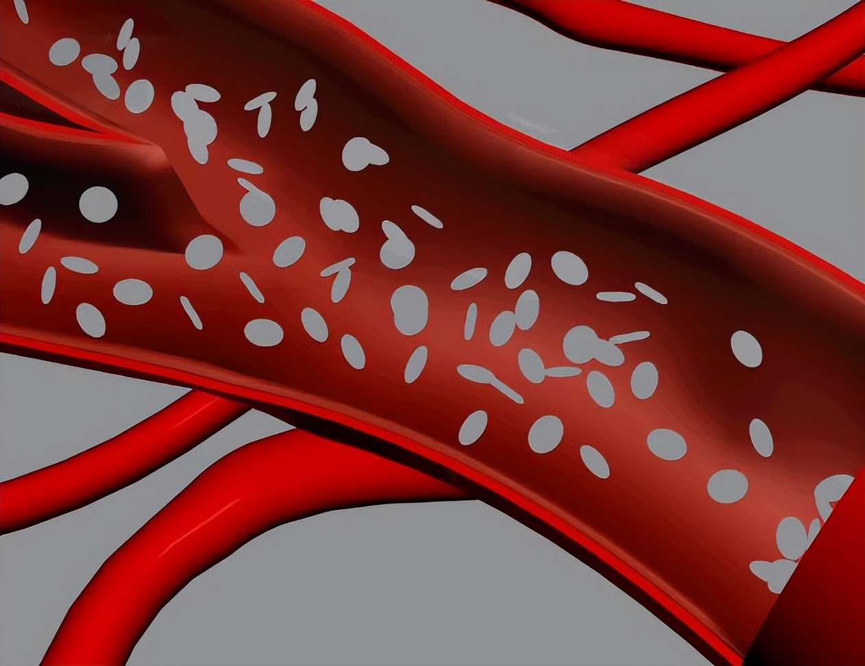 People with severe blood vessel blockage may have these 6 signs when ...