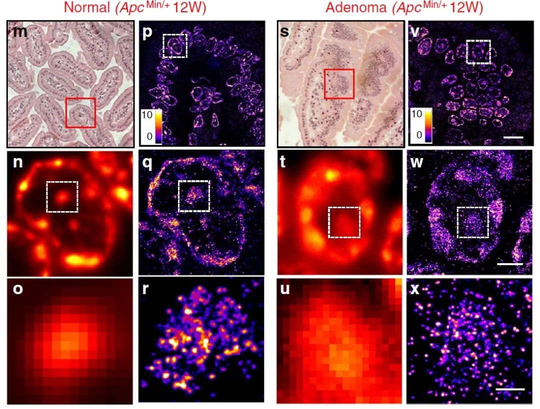 Stochastic optical reconstruction microscopy STORM reveals the ...