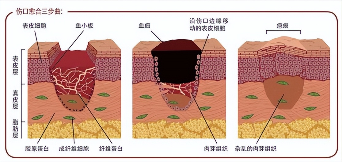 Does a child's facial bump injury need to be sutured or treated with ...