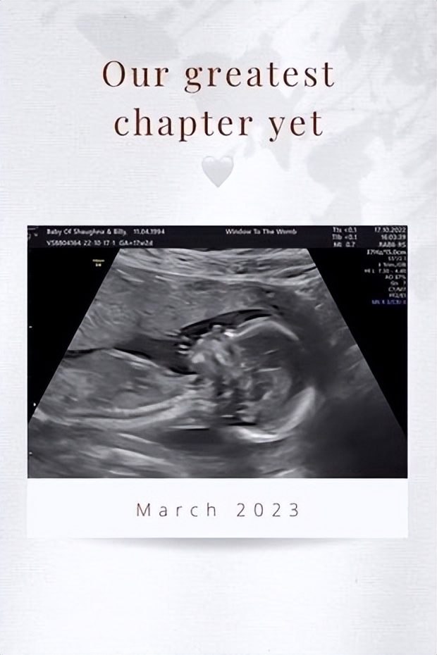 Love Island's Shauna Phillips announces she's pregnant with her first ...