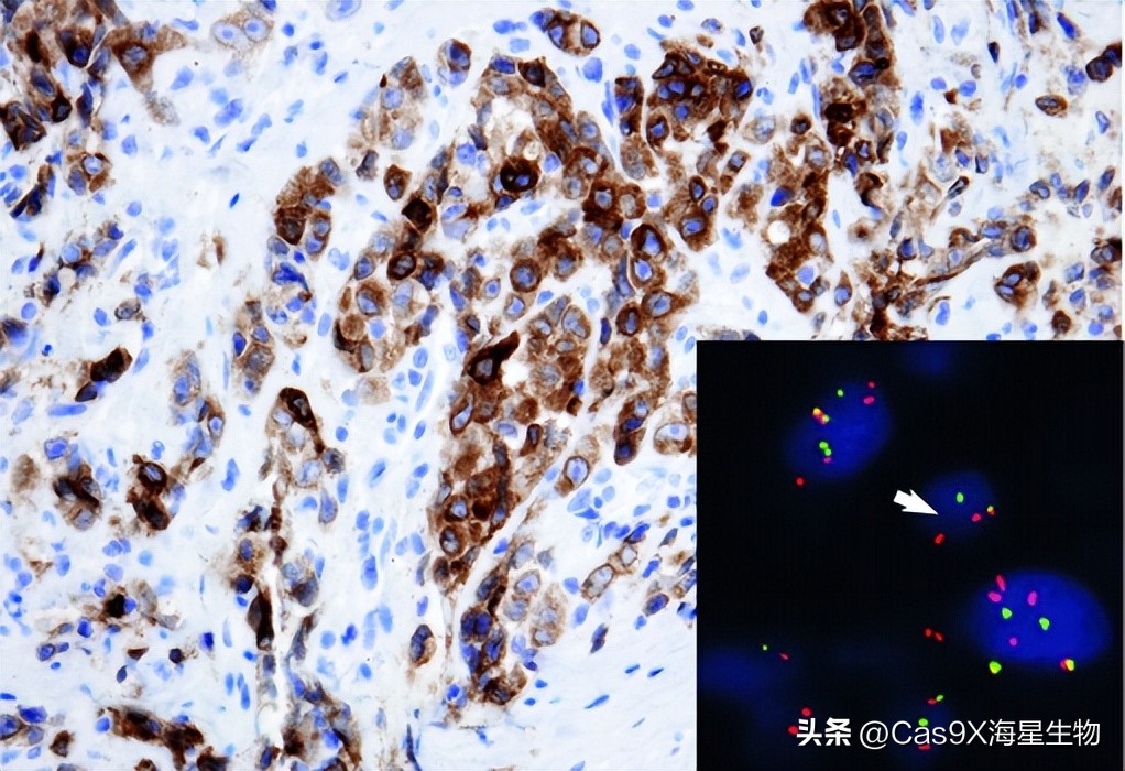 HyCyte®融合基因檢測方法與RNA標準品 - 頭條匯