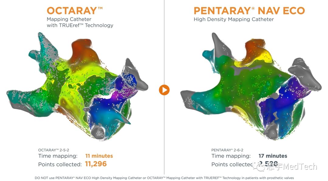 Quick heart modeling!Johnson & Johnson Launches Upgraded Mapping ...