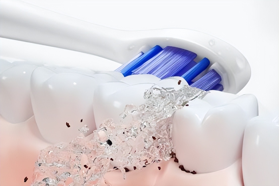 Don't Dentists Recommend Electric Toothbrushes?In-depth analysis of ...