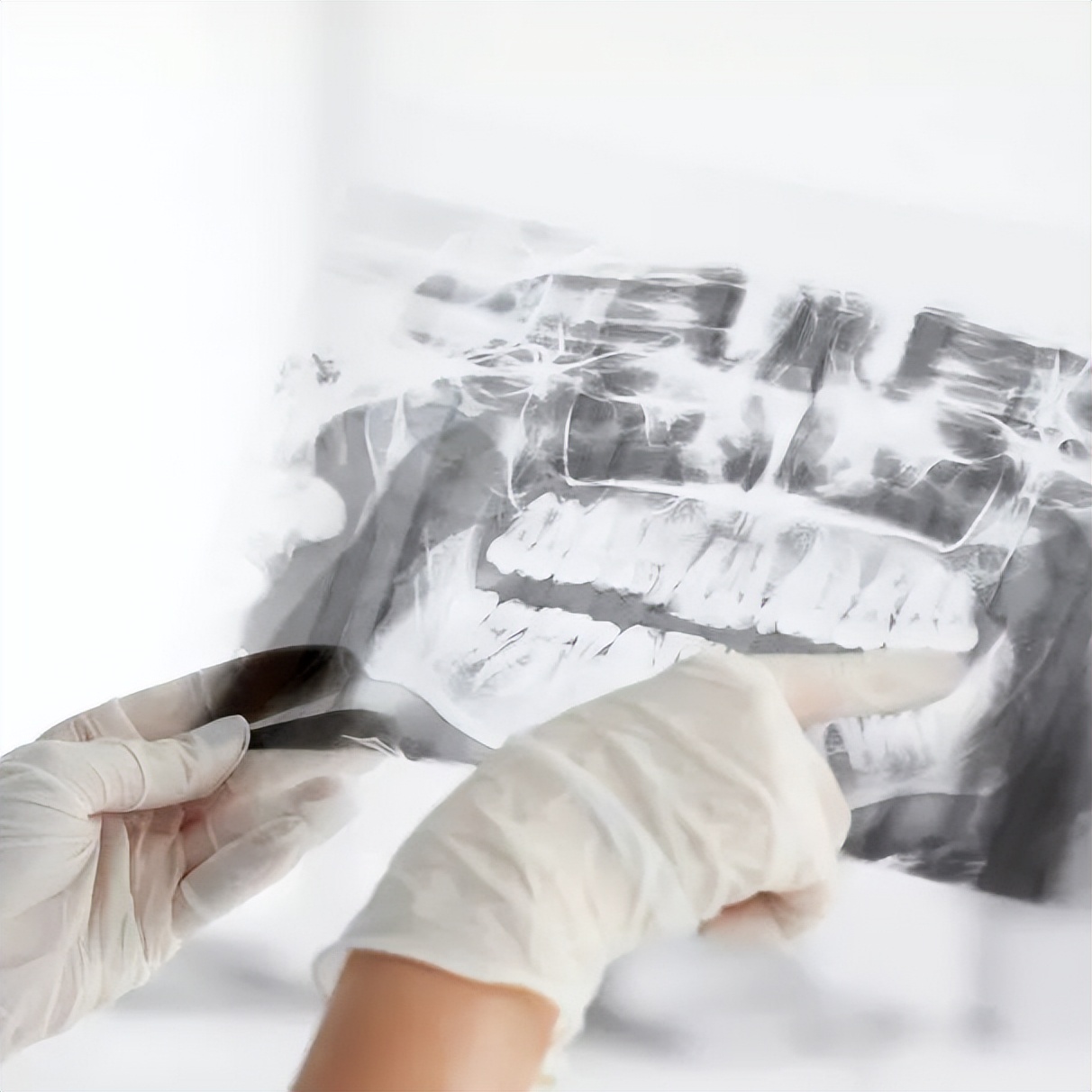 Is invisible orthodontics suitable for teenagers? - iMedia