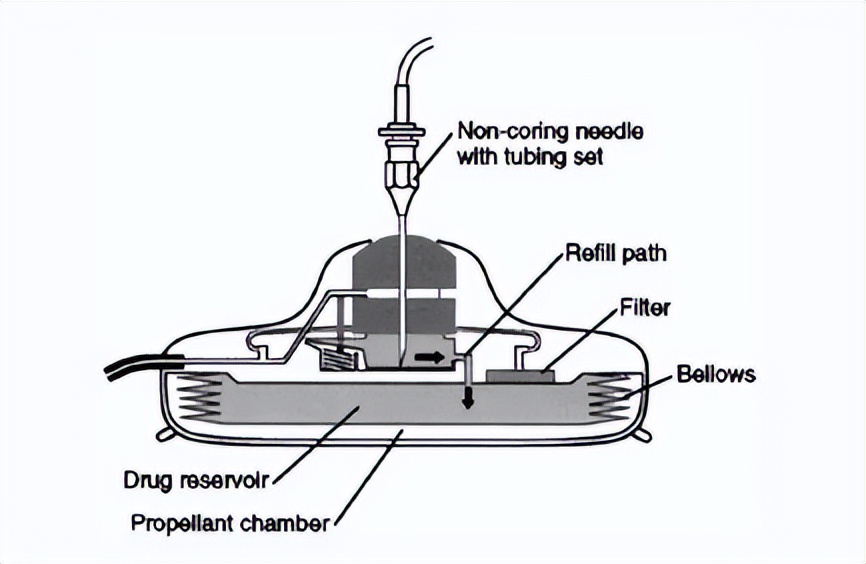 What about the PICC and infusion port of discharged patients? - iNEWS