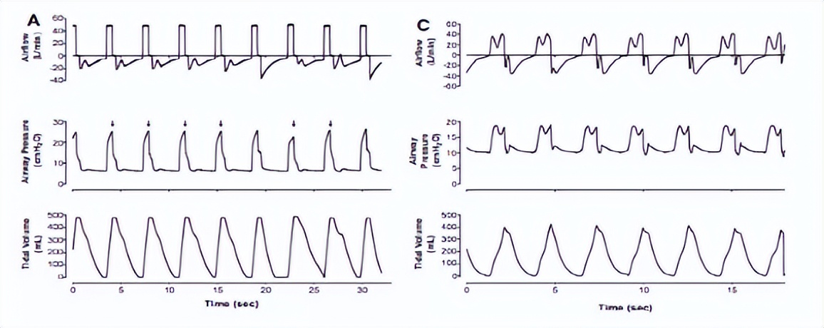 Professor Luo Hong: How to identify "reverse trigger" during mechanical ...