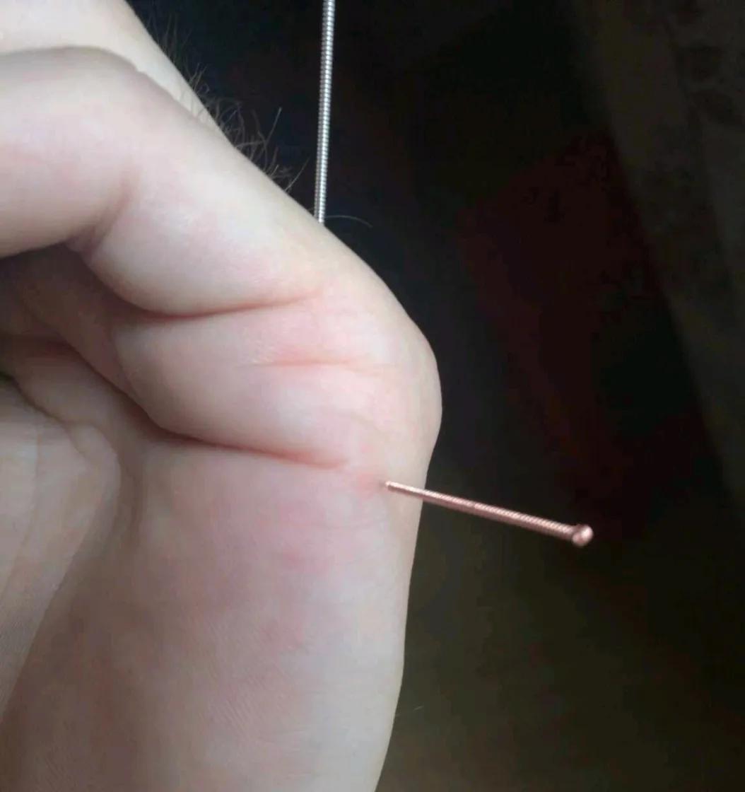 One Needle for Numbness and Pain in Houxi Tou Lao Palace - iNEWS