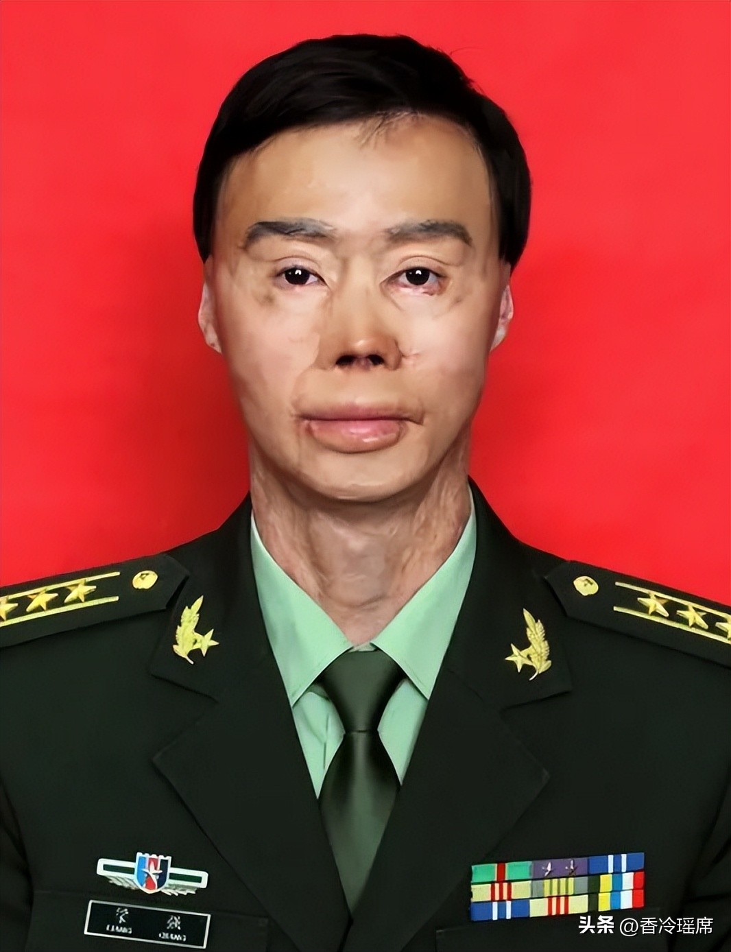 In 1995, soldier Liang Qiang was severely burned to save 27 passengers ...