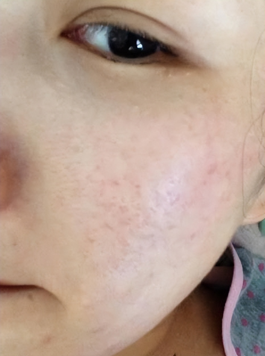 "Long-term makeup" and "long-term makeup" which is better for the skin ...