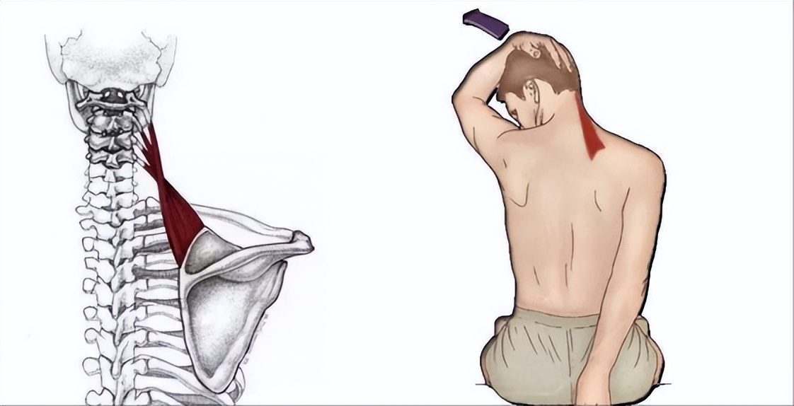 Round shoulders, hunched back, long and short legs, correct posture in ...