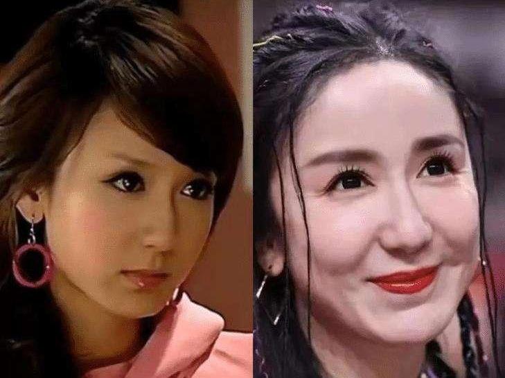 Several stars with excessive plastic surgery, with stiff faces and ...