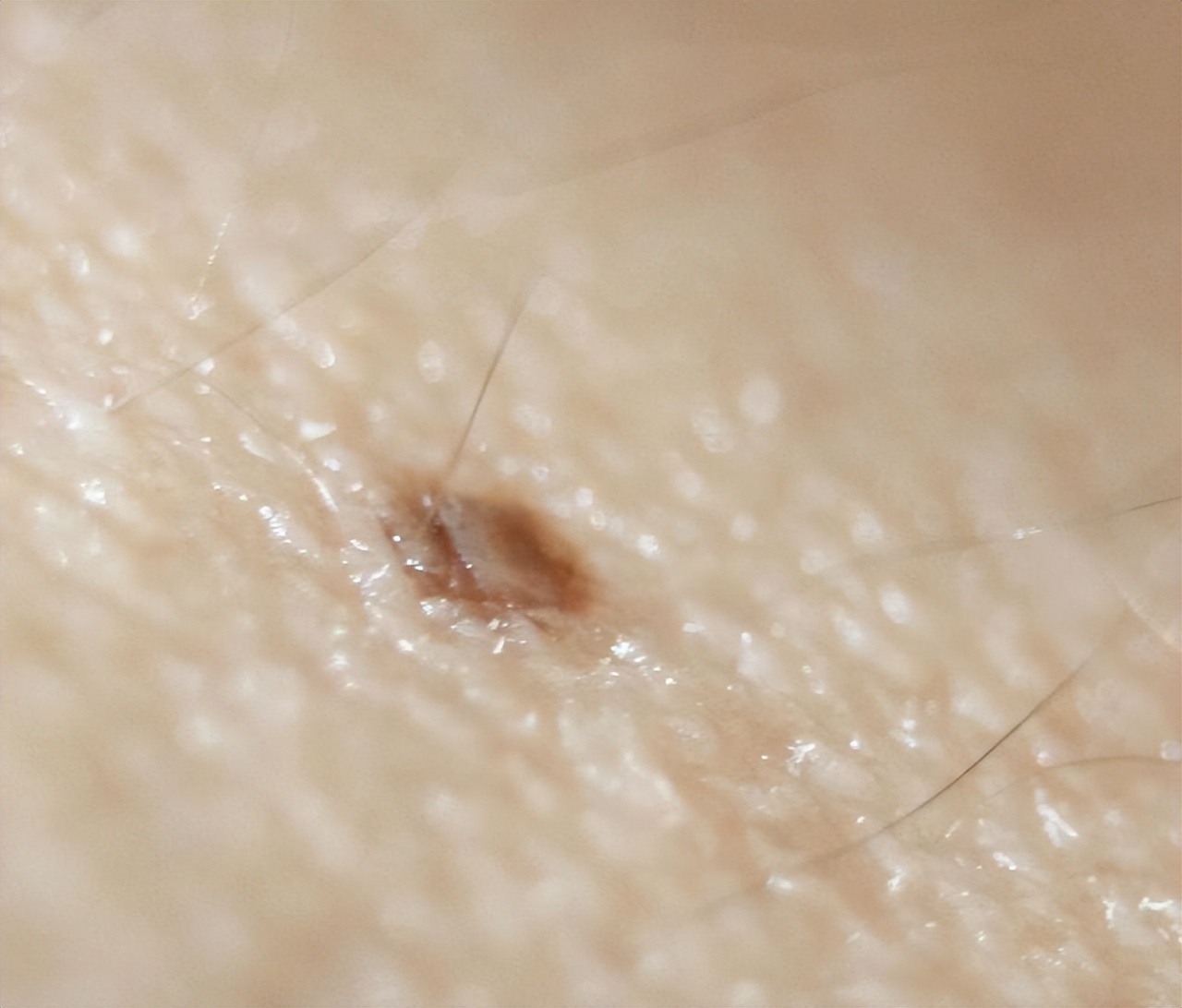 The well-known singer died of illness, what is the culprit "melanoma ...